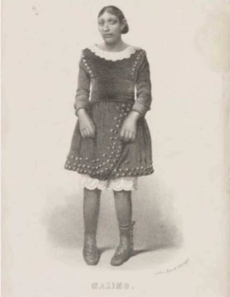 La historia de Máximo y Bartola, los niños salvadoreños exhibidos como ...