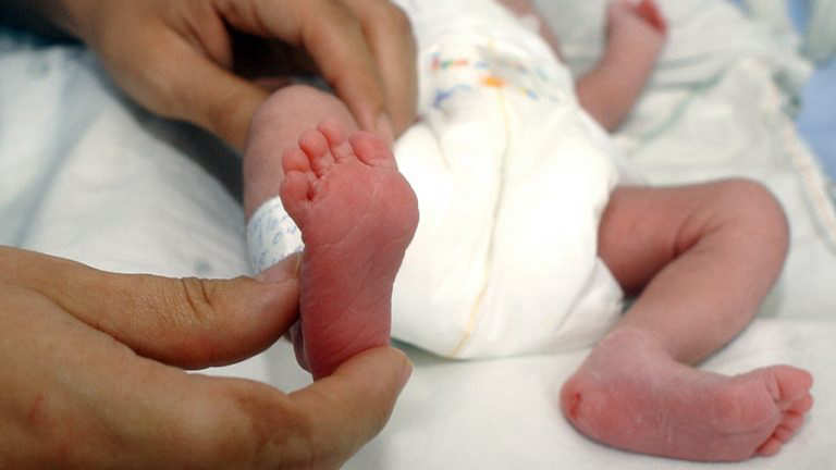 Conoce El Caso Del Nacimiento De Un Bebé Sin Rostro Que Ha Estremecido