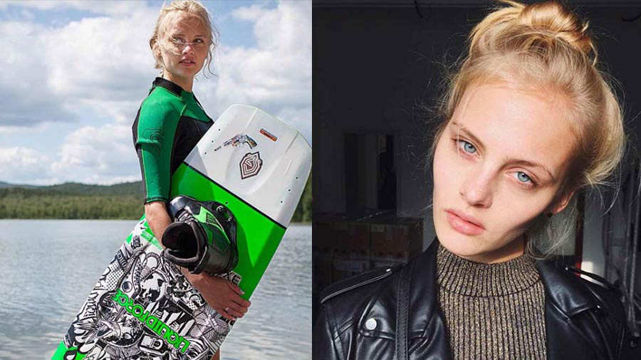 Modelo rusa lucha por su vida después de caer desnuda desde el ...