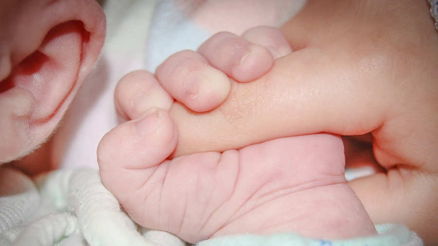 El Insólito Caso De Una Niña Que Nació Con Una Segunda Boca Dos