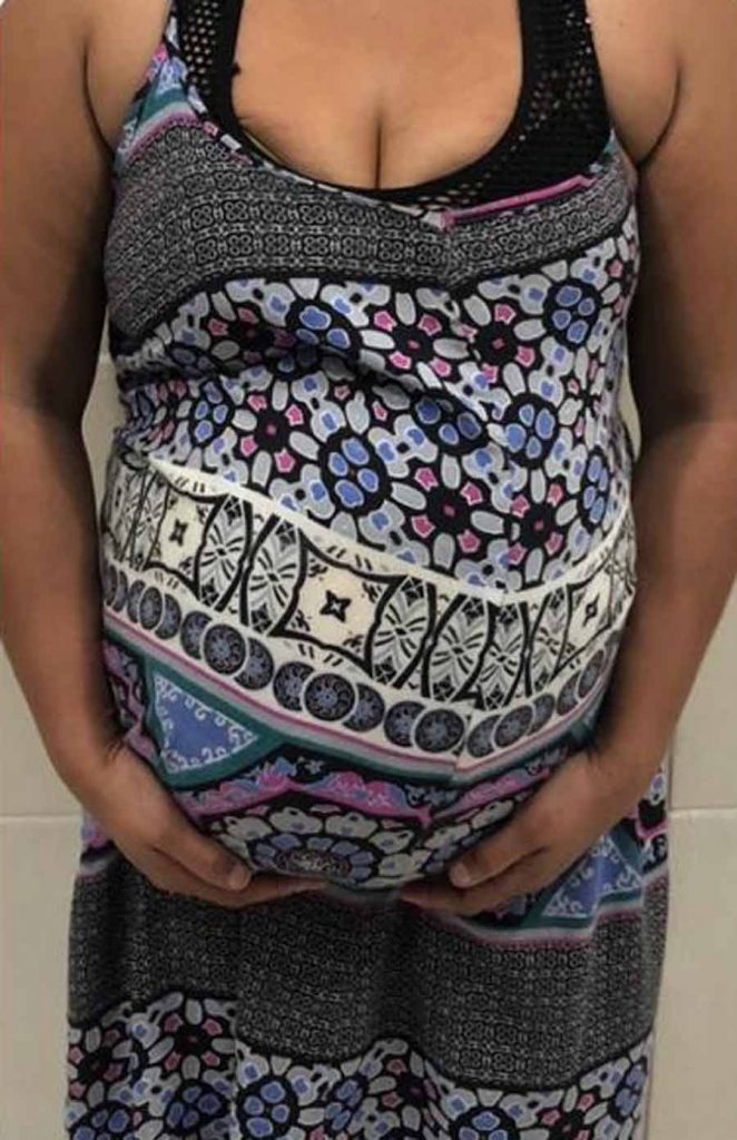 Mujer finge embarazo de una manera insólita para transportar droga en Brasil | Noticias de El ...