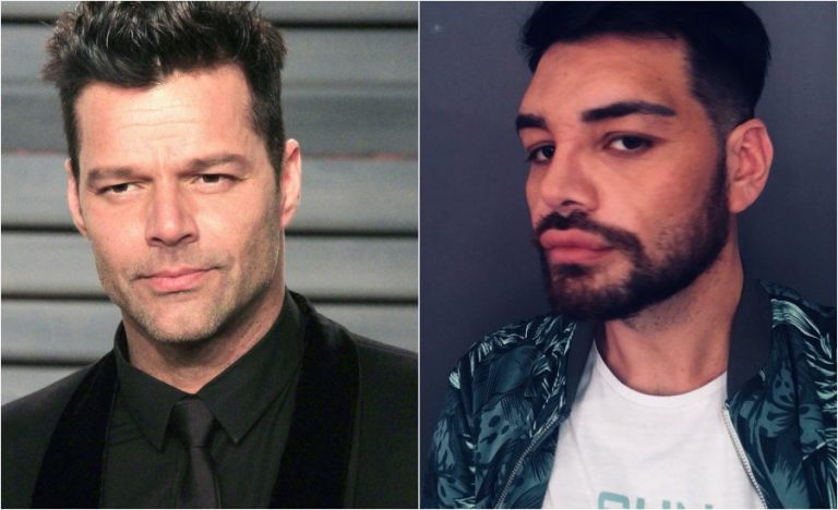 FOTOS: Hombre se hizo más de 25 operaciones para lucir como Ricky ...