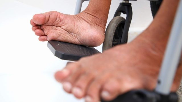Poliomielitis, la enfermedad paralizante que vuelve a amenazar